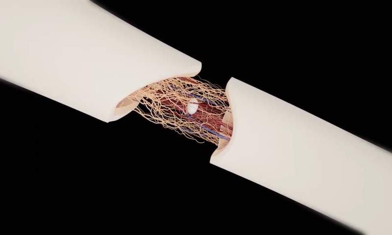 Automated plate streaking • healthcare-in-europe.com