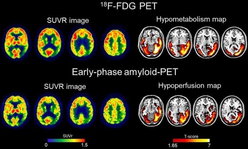 World isotope shortage threatens scans • healthcare-in-europe.com