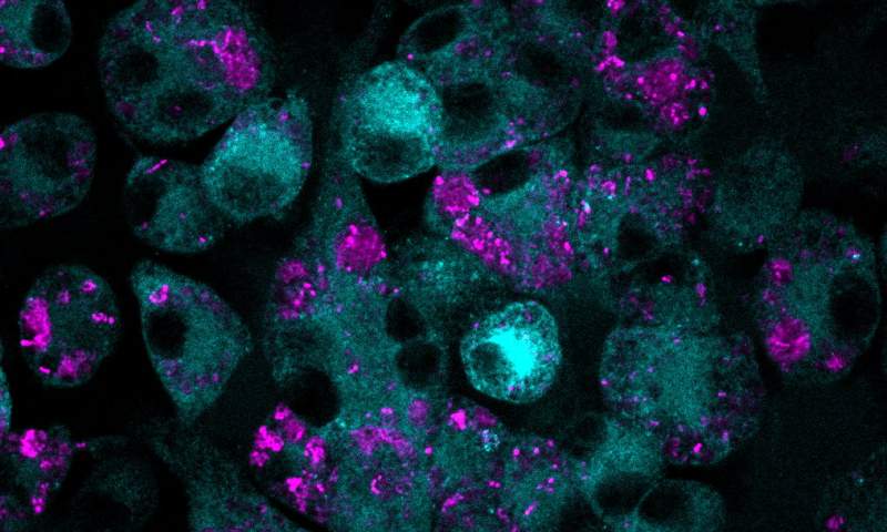 How lab bacteria became 'estranged' from their real-life counterparts ...