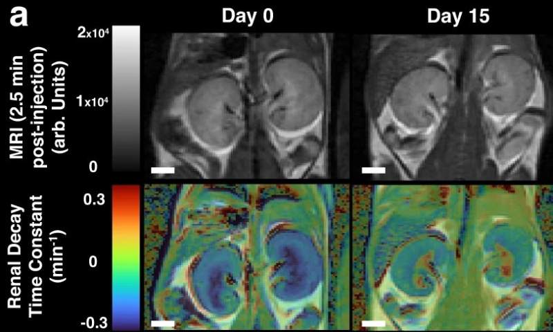 New MRI technique saves kidneys from gadolinium damage • healthcare-in ...