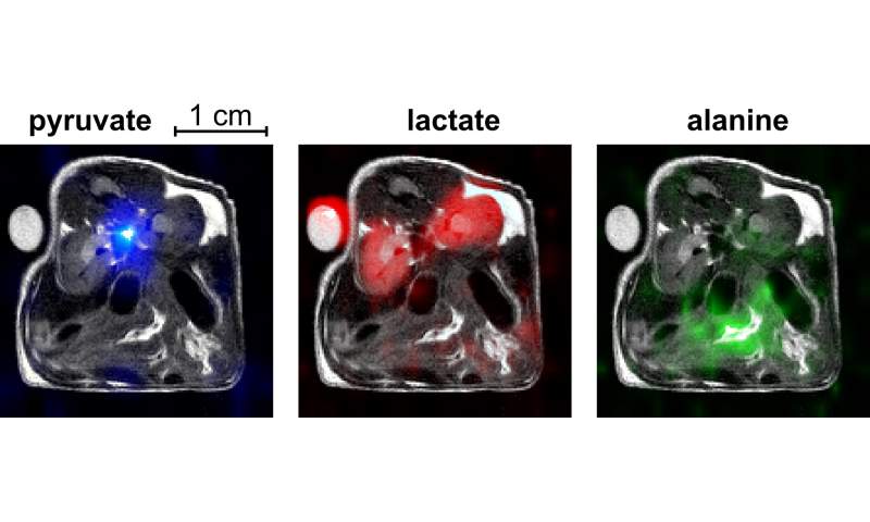 New MRI technique to enhance metabolic imaging • healthcare-in-europe.com