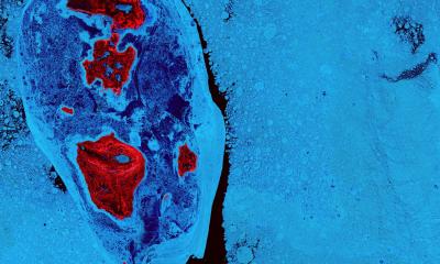 Climate change thaws ancient frozen bacteria – how dangerous are they ...