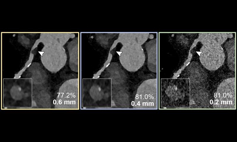 Mapping heart diseases • healthcare-in-europe.com