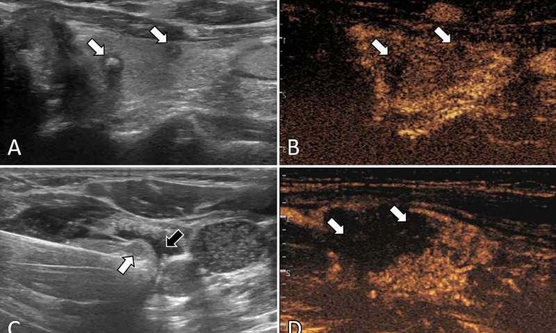 Water jet dissection • healthcare-in-europe.com