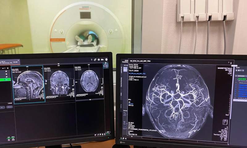 Post-COVID: Nervensystem nimmt selten Schaden • healthcare-in-europe.com