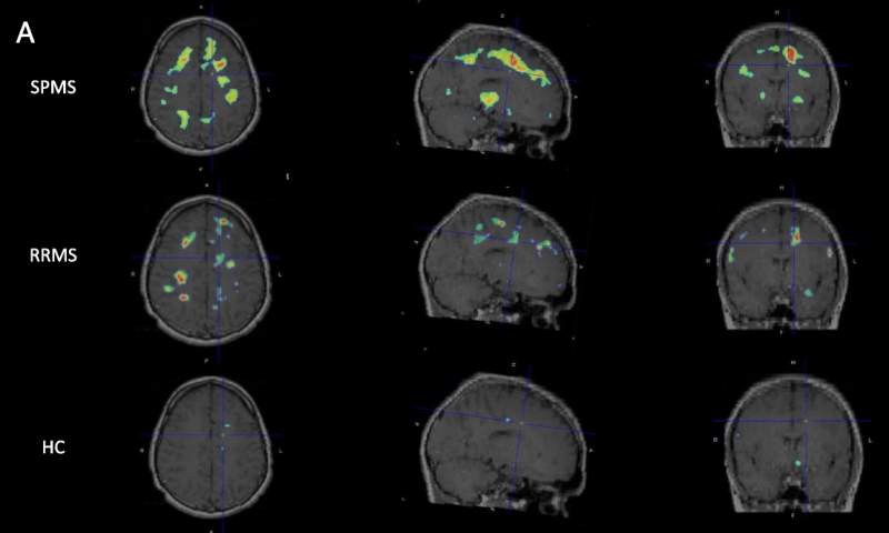 World isotope shortage threatens scans • healthcare-in-europe.com