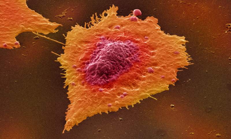 World's first digital cancer cell model • healthcare-in-europe.com