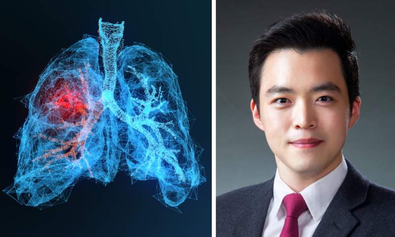 Lung cancer care: addressing inequalities across Europe • healthcare-in ...