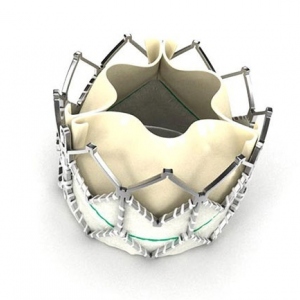 TAVI/TAVR • healthcare-in-europe.com