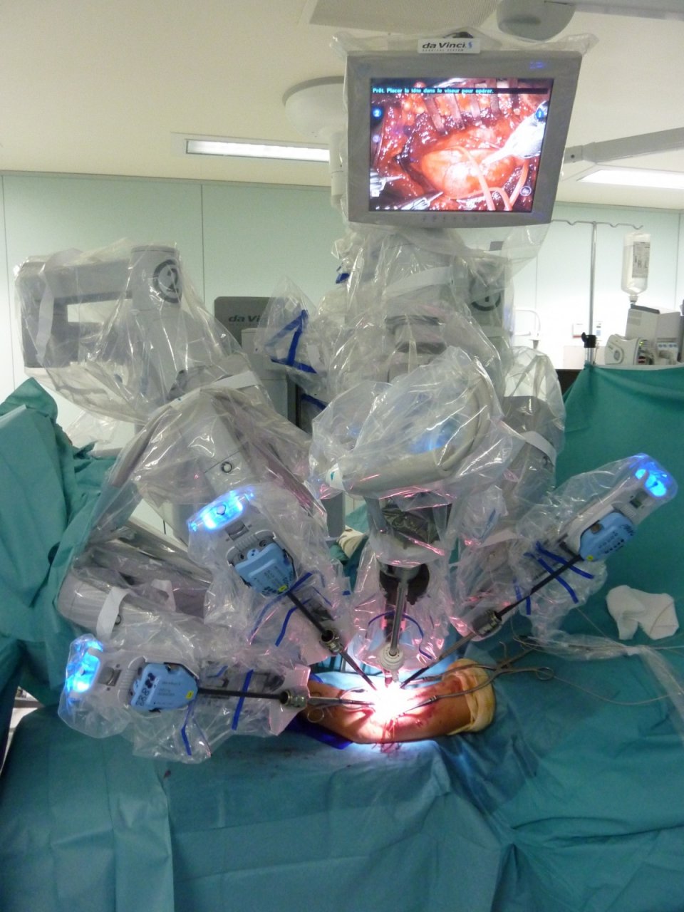 Robots hold a steadying role in microsurgery • healthcare-in-europe.com
