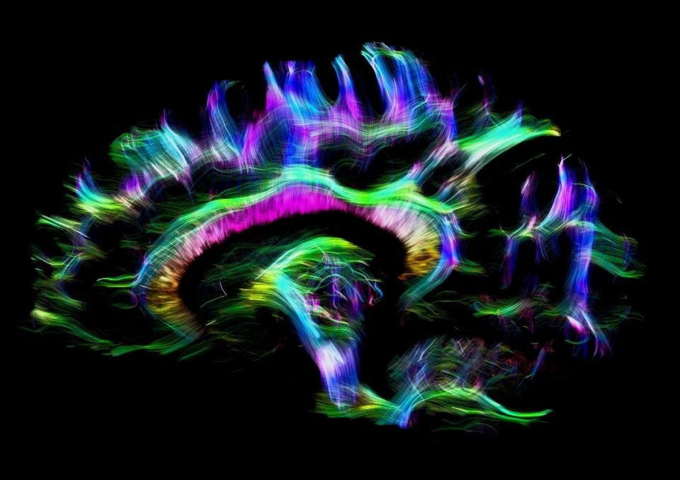 Experten für Ultrahochfeld-MRT nominiert • healthcare-in-europe.com