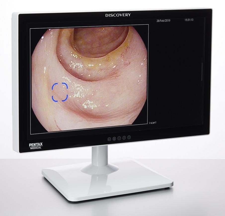 Ai Assisted Polyp Detector Receives Ce Mark • Healthcare In