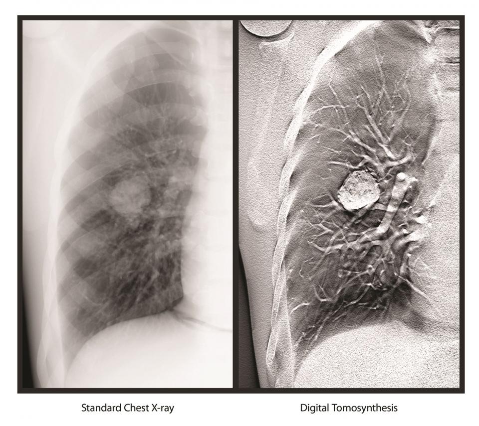 FDA clearance for Digital Tomosynthesis • healthcare-in-europe.com