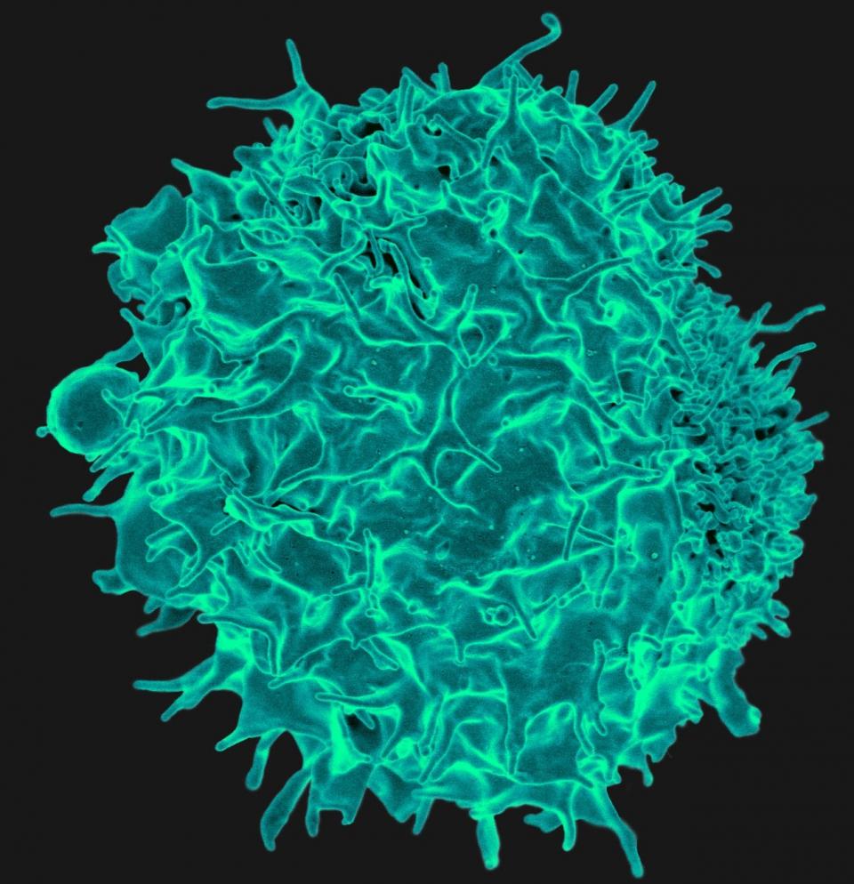 New T-cell could make ‘universal’ cancer therapy possible • healthcare ...
