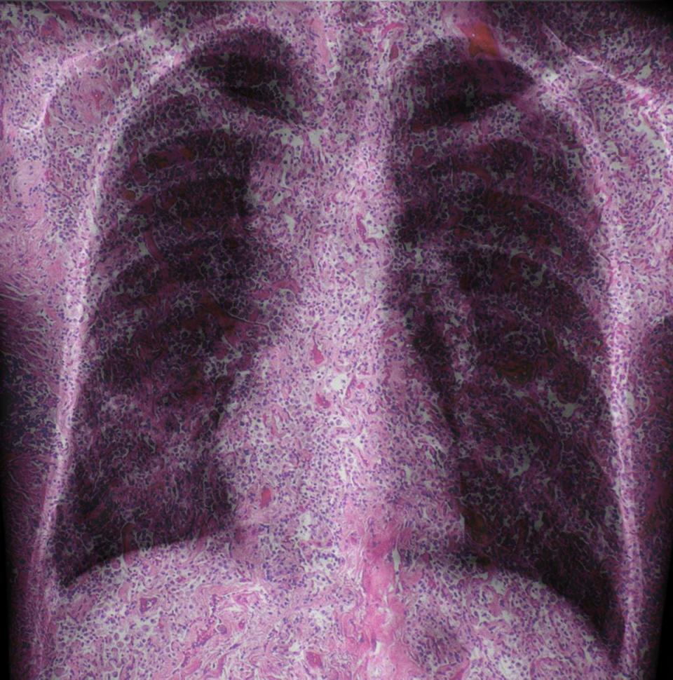 Radiologists, pathologists and geneticists gather around a digital ...