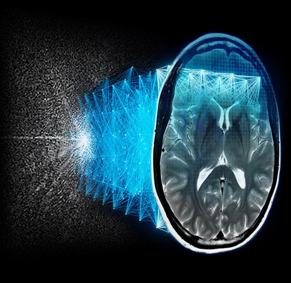 New Levels of Precision with Self-learning Imaging Software ...