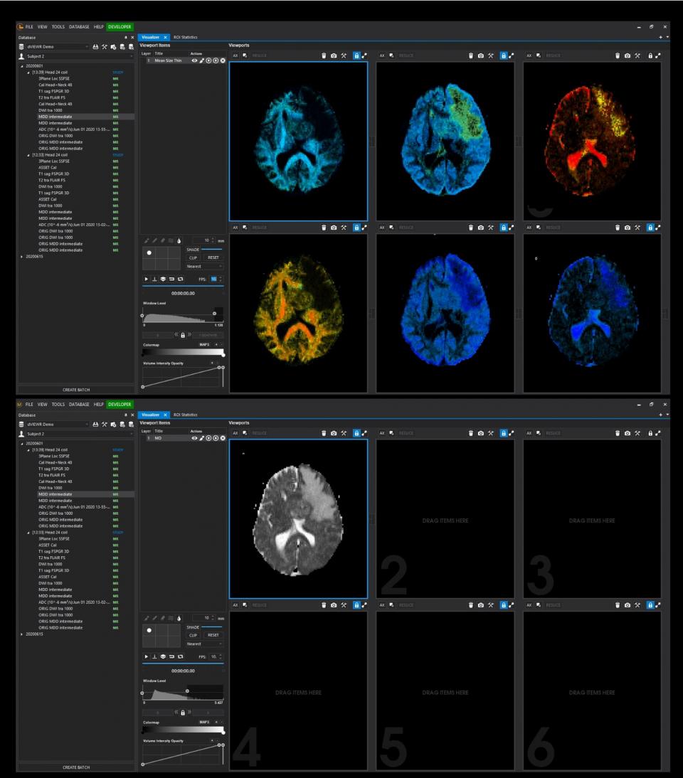 MRI image analysis and workflow software platform launched • healthcare ...