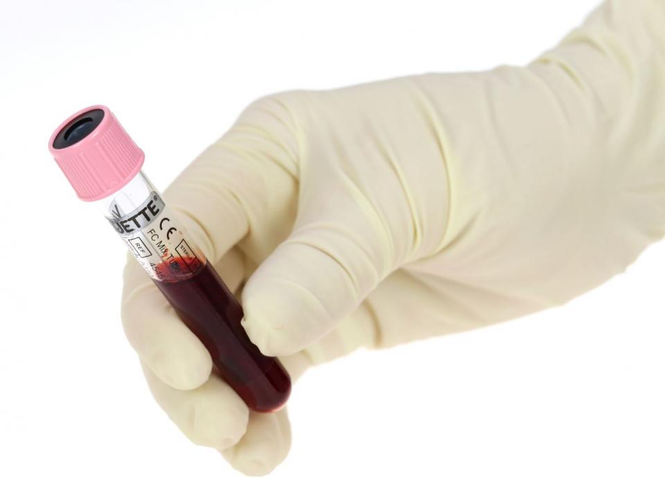 Glucose stabilisation right from the beginning • healthcare-in-europe.com