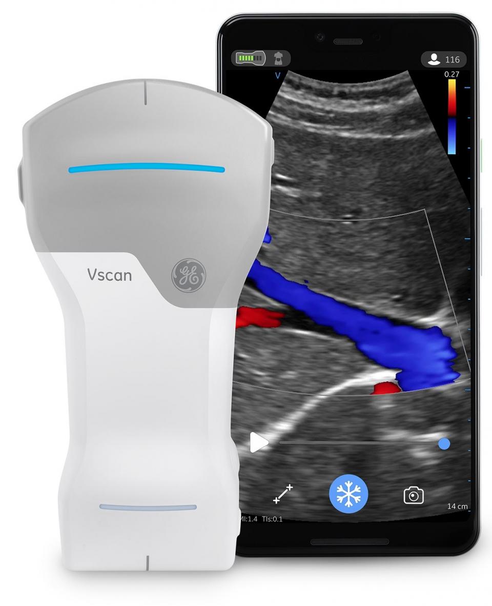 Ultrasound might be the next stethoscope • healthcare-in-europe.com