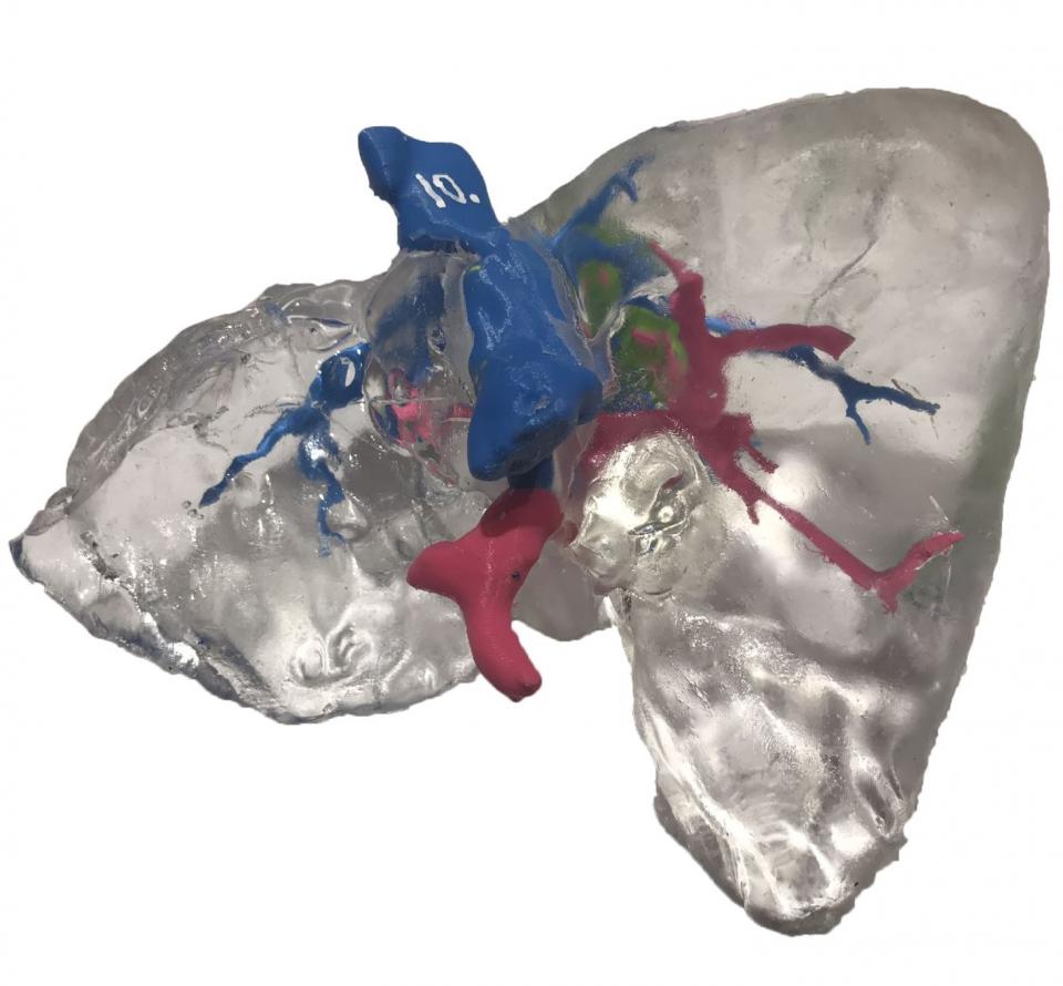 How normal cells turn into liver cancer cells • healthcare-in-europe.com