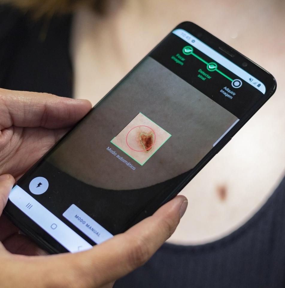AI-powered app to speed up skin cancer diagnoses • healthcare-in-europe.com