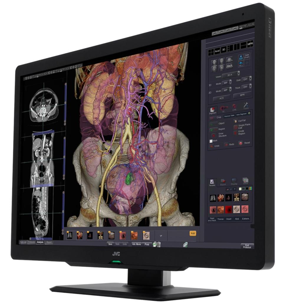 Evolution in Monitor Technology • healthcare-in-europe.com