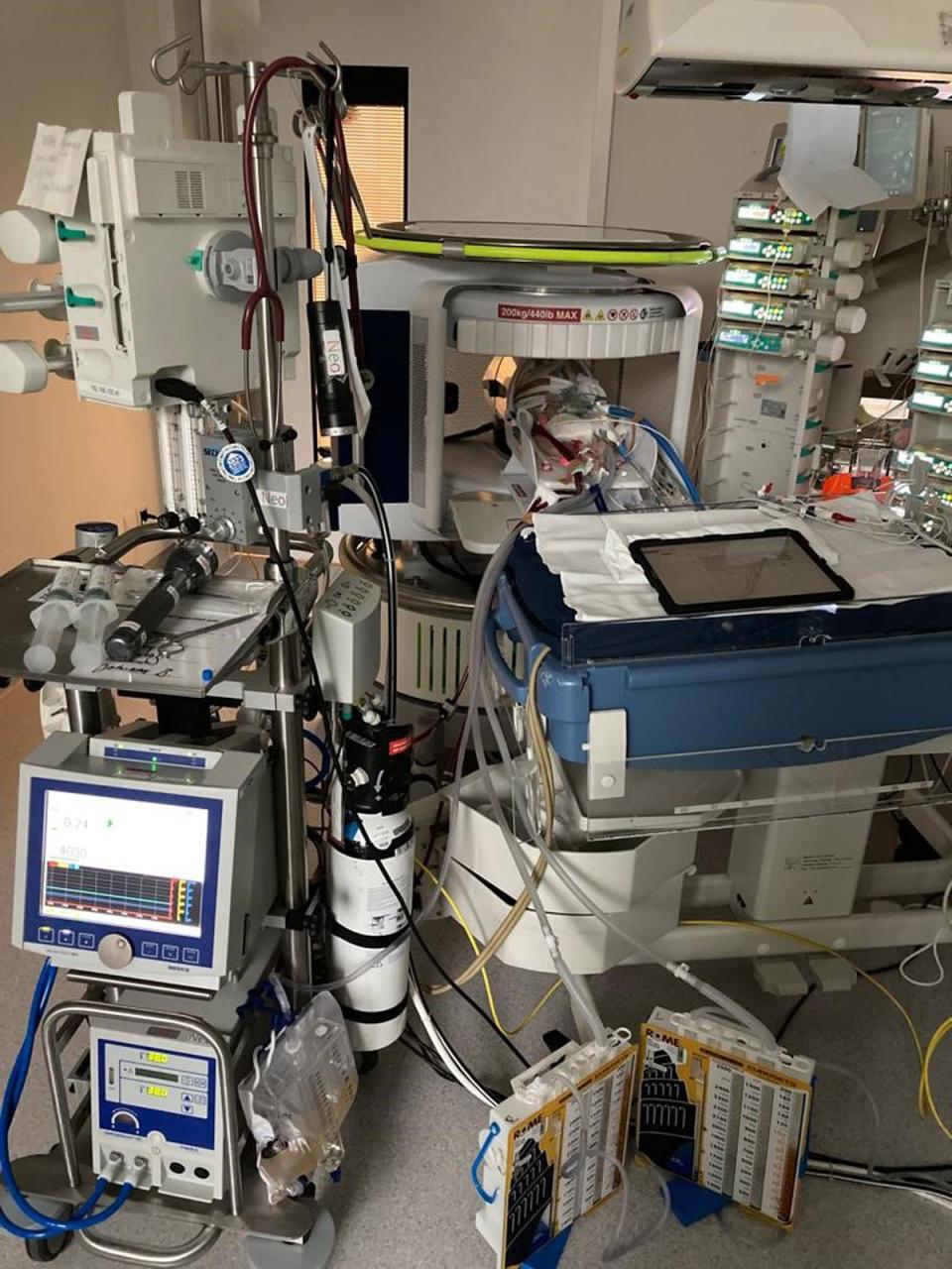 Portable MRI in pediatric ECMO patients: promising premiere ...