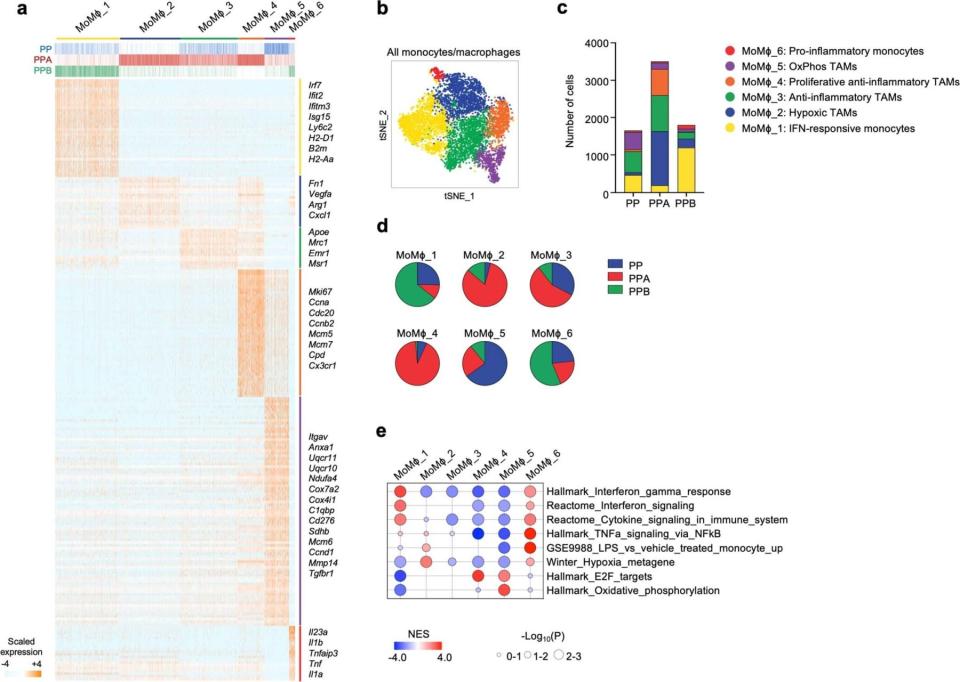 Study shows mechanism of PTEN-deficient breast cancer • healthcare-in ...