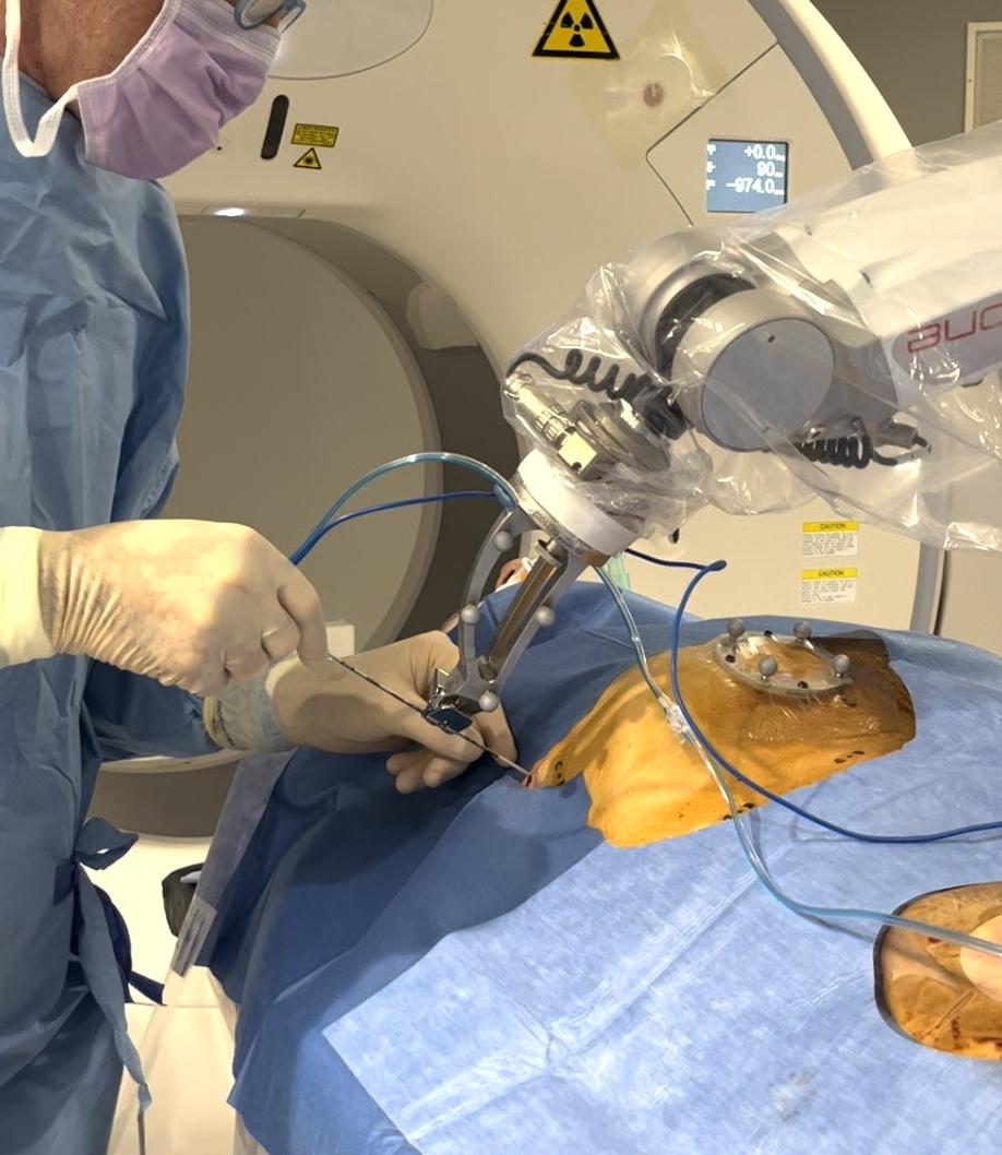 Robots push the boundaries of interventional radiology • healthcare-in ...