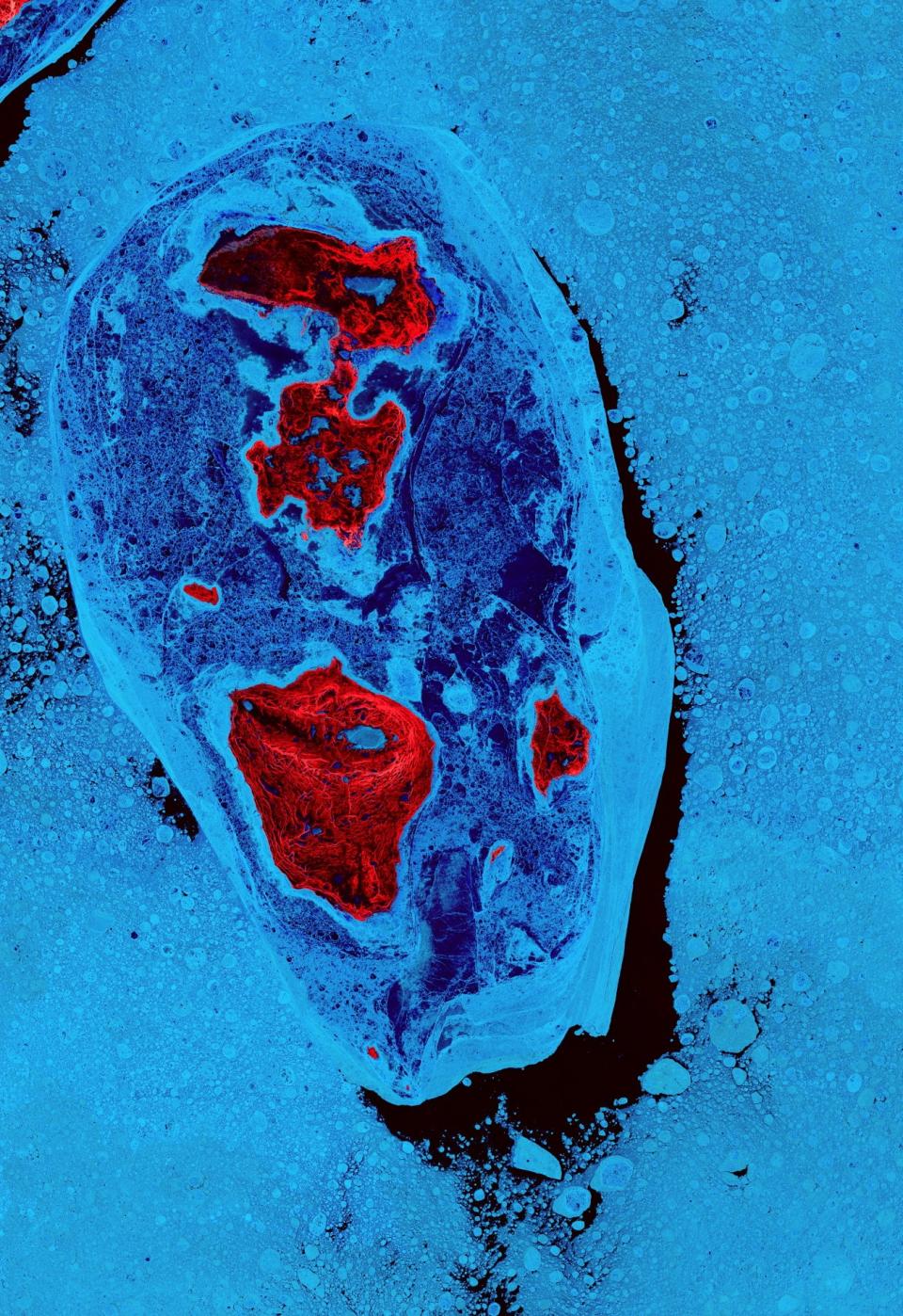 Climate change thaws ancient frozen bacteria – how dangerous are they ...