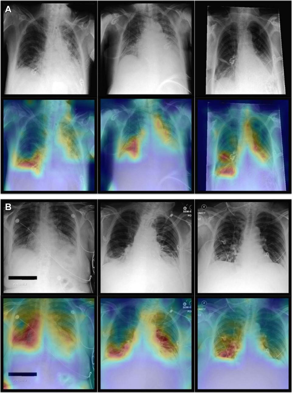 Chest X-rays + patient data + AI = better diagnosis? • healthcare-in-europe.com