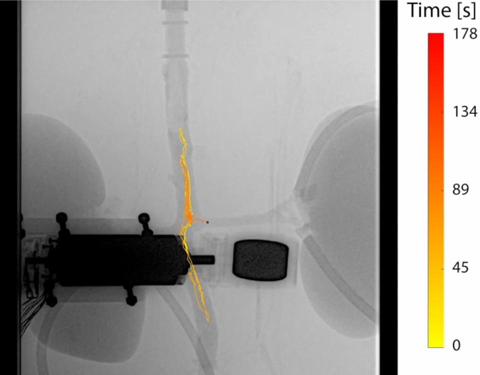 Wireless mini robots successfully navigate arteries • healthcare-in ...