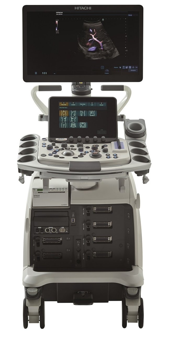 Symphonie in Bild und Technologie: ARIETTA 850 • healthcare-in-europe.com