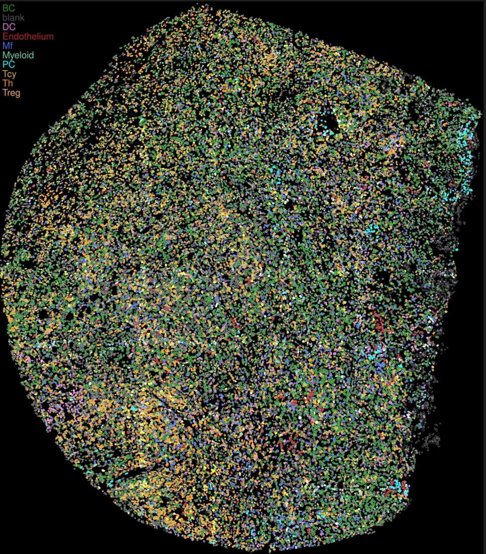Multiplexed staining techniques in the fight against complex diseases ...