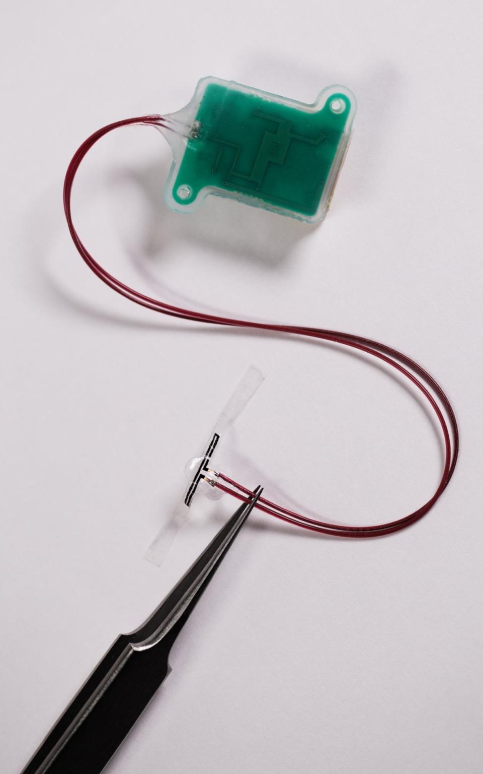 New device monitors bladder fullness • healthcare-in-europe.com