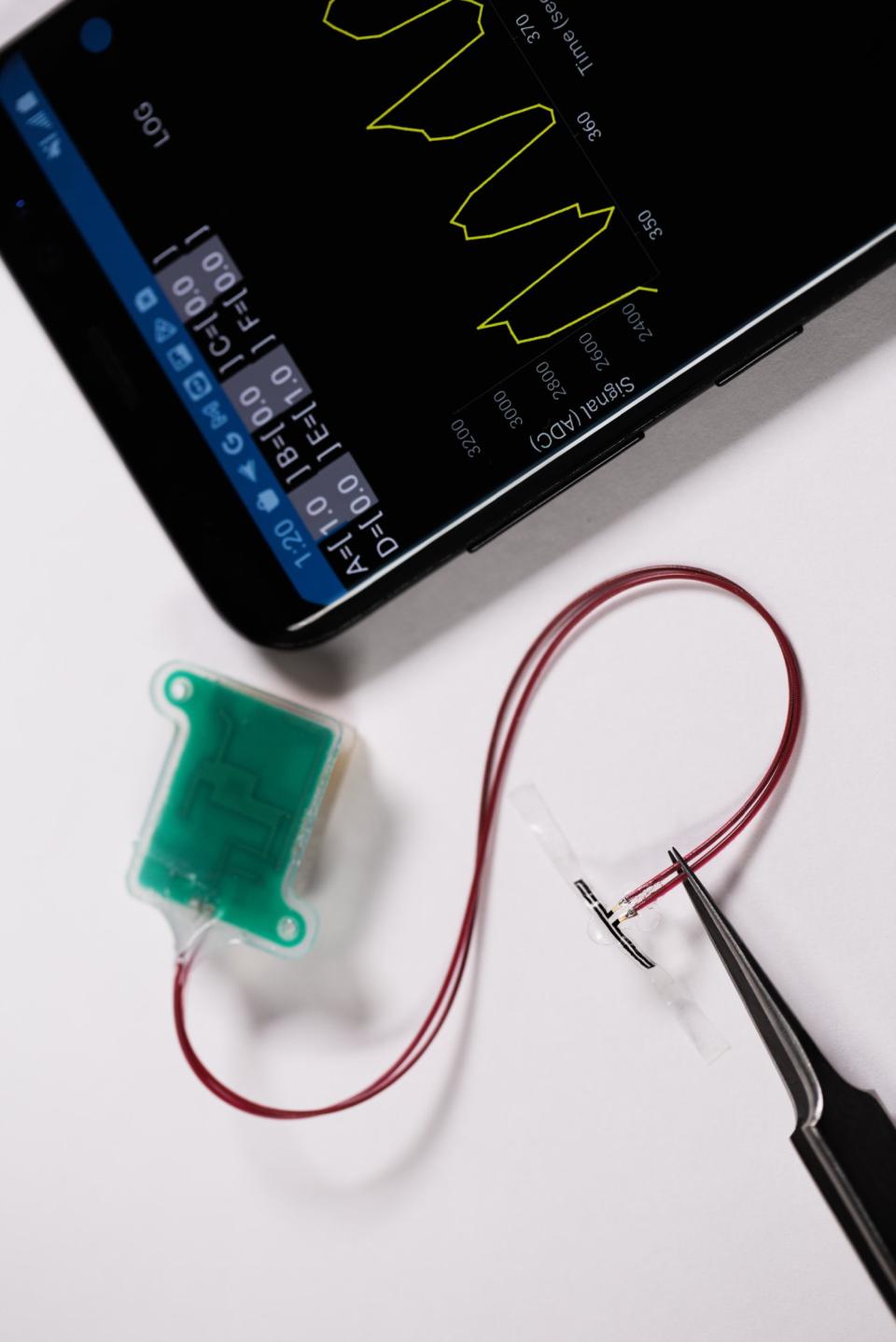 New device monitors bladder fullness • healthcare-in-europe.com