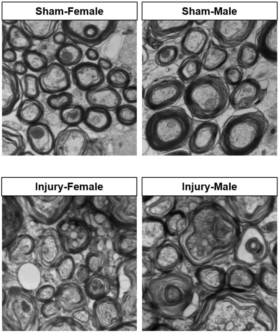 Male and female brains are different – and so are the effects of ...
