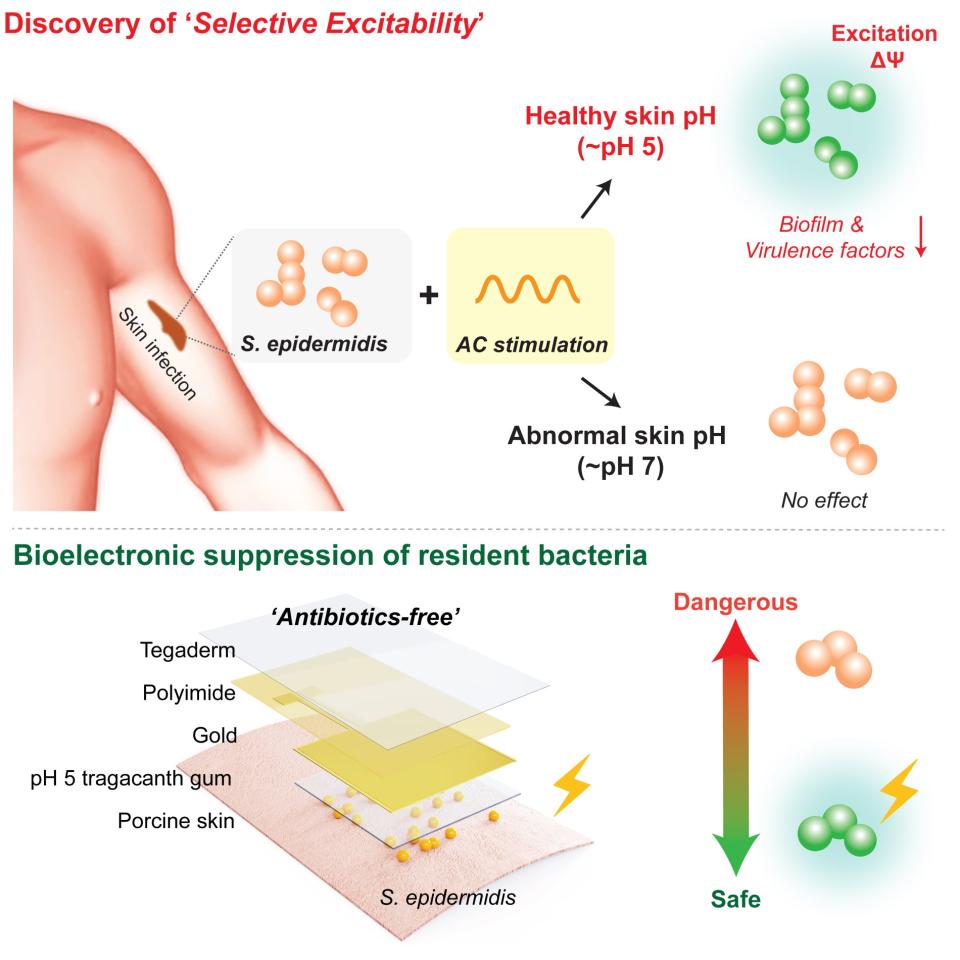Bioelectronic patch 'electrifies' bacteria to prevent infections ...