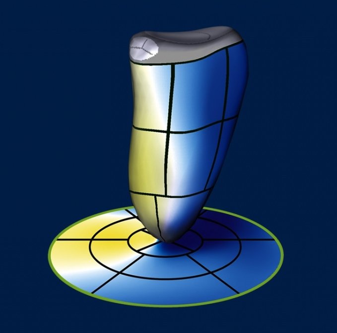 Philips stärkt Softwaresparte durch Übernahme von TomTec • healthcare ...