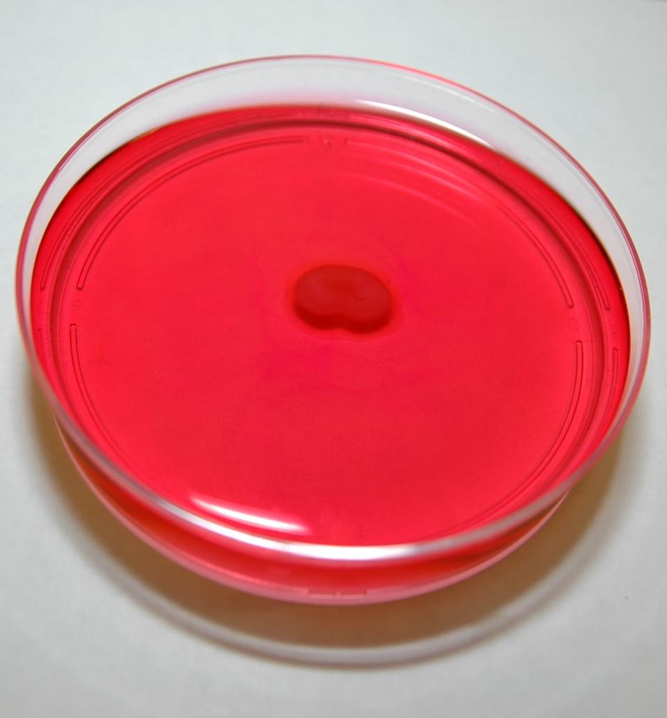 3D bioprinting a functional spinal disc • healthcare-in-europe.com