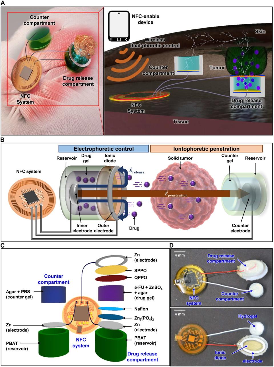 Wireless NFC implant delivers chemotherapy deep into tumors ...