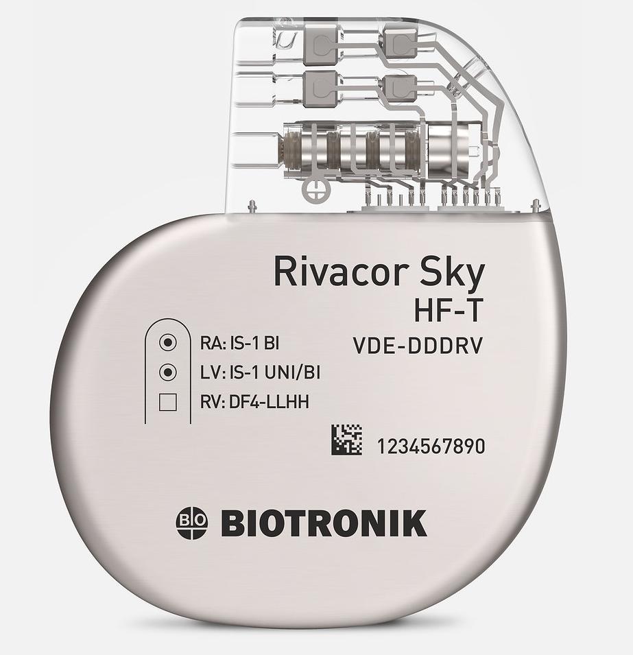 Erste Implantation eines CRT-D-Systems für LBBAP-Stimulation ...