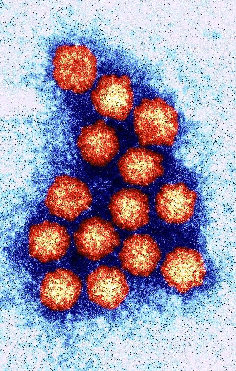 New approach to norovirus vaccine and drug development • healthcare-in ...