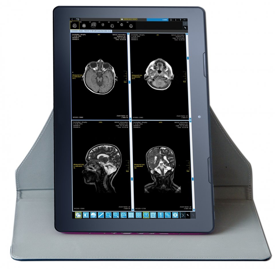 Launching: the portable medical imaging workstation • healthcare-in ...