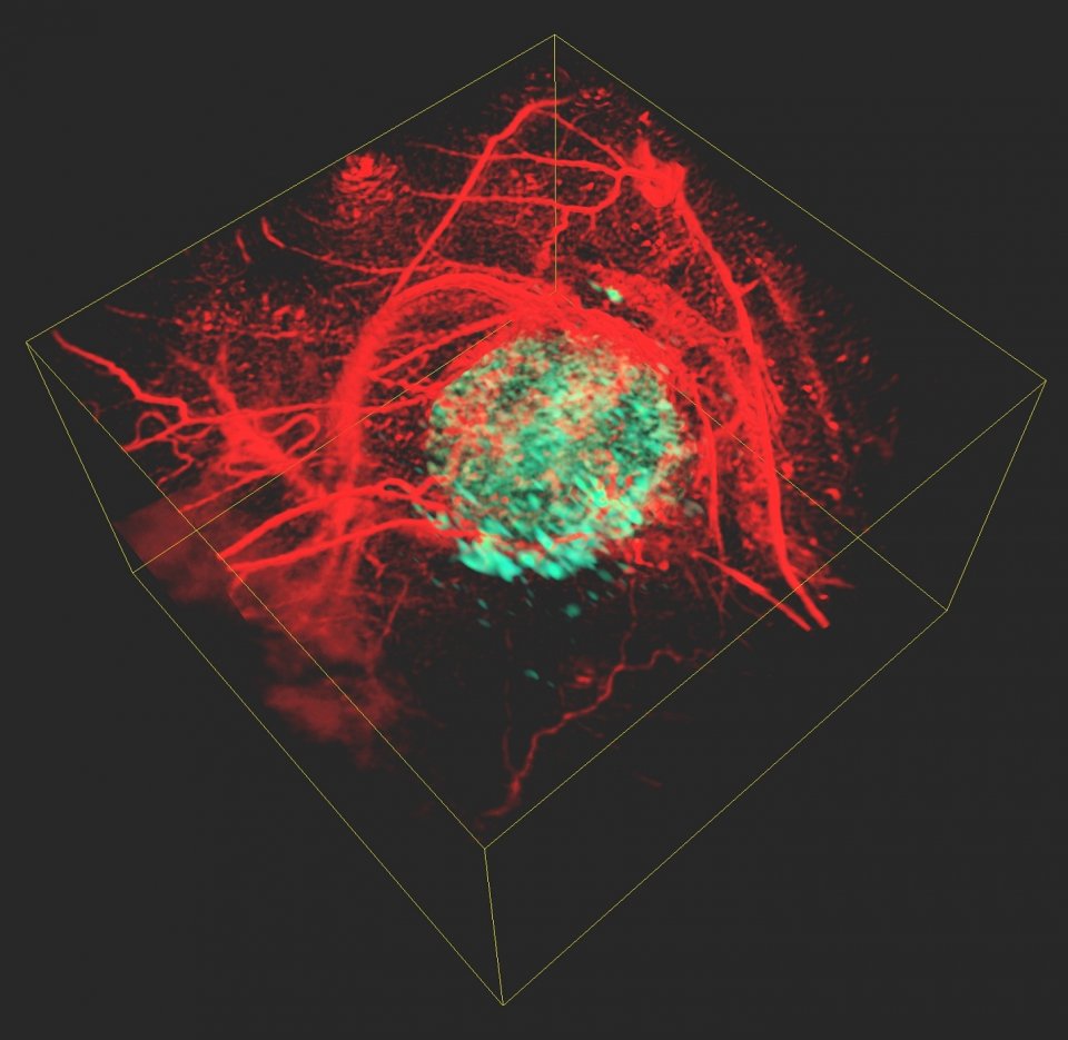 New method shows 3D images of cancer cells in the body • healthcare-in ...